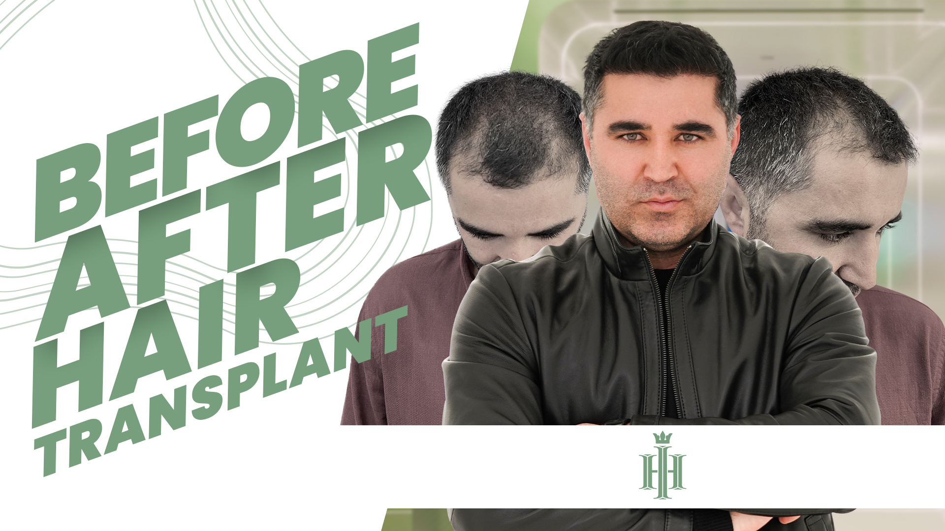 Gallery | Hair of Istanbul