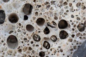 Hair Transplant Trypophobia: Say Goodbye to Hole Fears