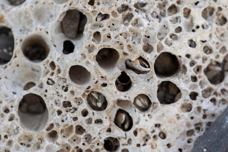 Hair Transplant Trypophobia: Say Goodbye to Hole Fears