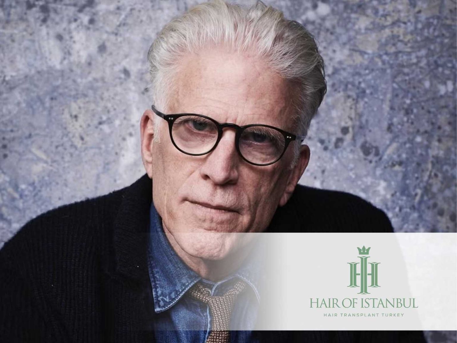 Is Ted Danson Bald Hair Transplant Facts | Hair of Istanbul