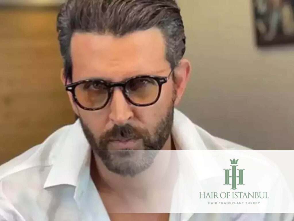 Hrithik Roshan Hair Transplant Natural Evolution Observed