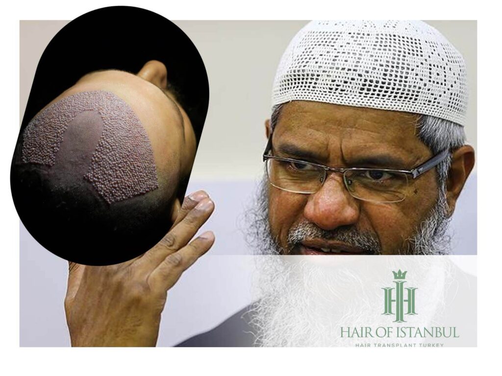 10 Best Haircuts for M Shaped Hairline: Transforming Looks