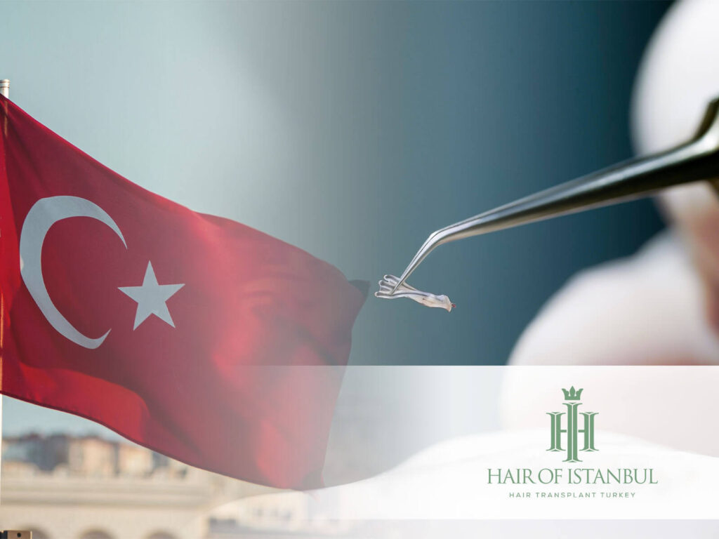 Is Ted Danson Actually Bald? The Enigma of His Hair Revealed