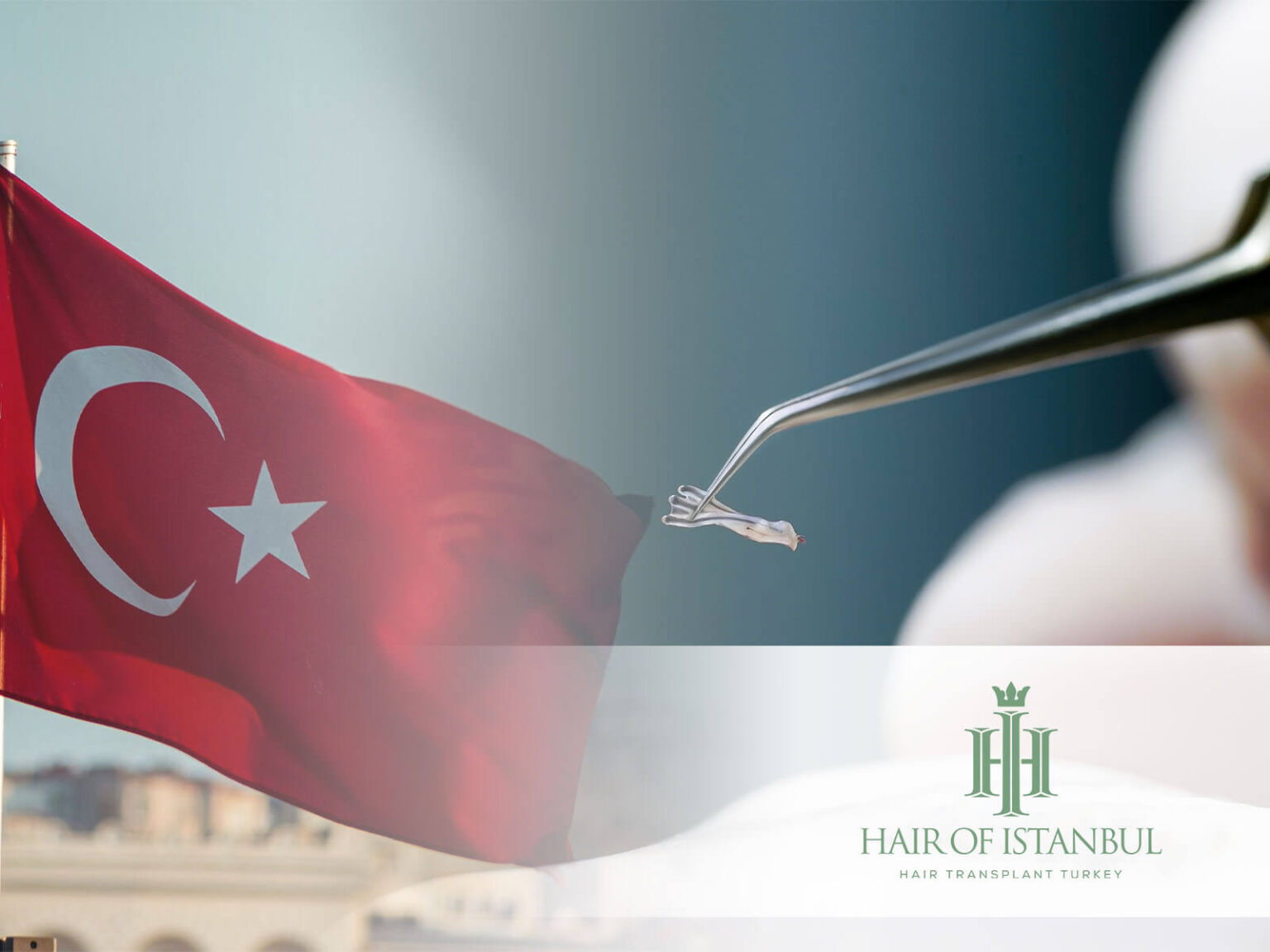 Is Ted Danson Actually Bald? The Enigma of His Hair Revealed