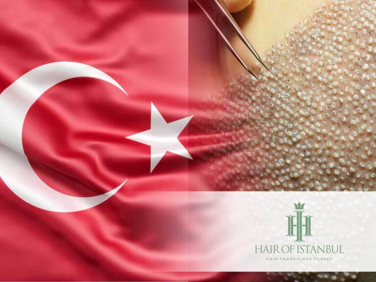 Is Ted Danson Actually Bald? The Enigma of His Hair Revealed